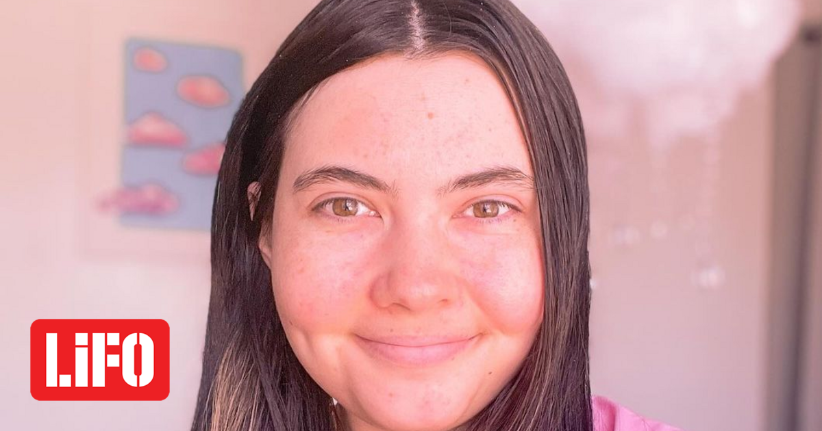 Η ζωή μιας 25χρονης που έχει αλλεργία στο νερό | LiFO